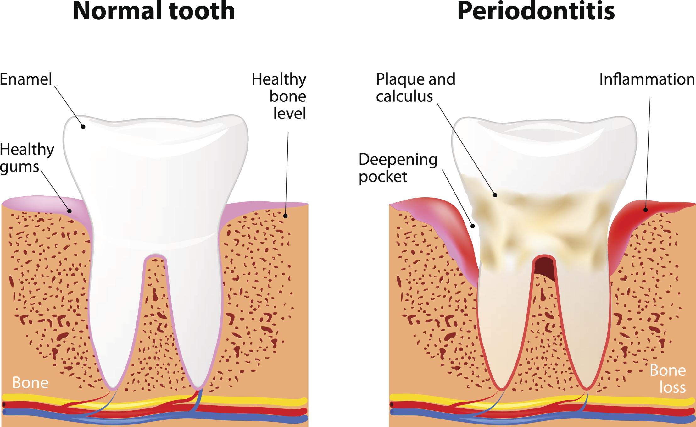 As We Begin to Get Long in the Tooth | Huntington Beach Dentist | HB ...